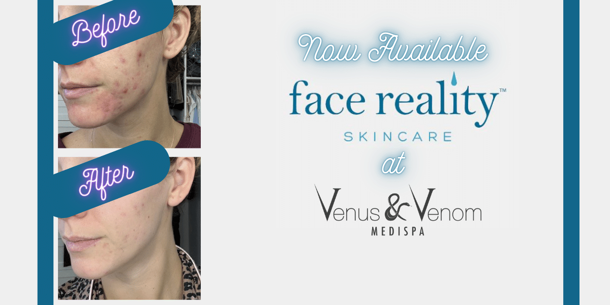 Injectables, Facials, Lasers and more | Venus & Venom